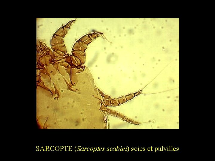 ECTOPARASITES ARTHROPODES INSECTES ACARIENS INSECTES 3 paires de