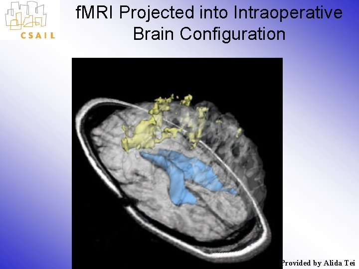 Image Guided Surgery 1 Conventional Surgery Seeing surfaces