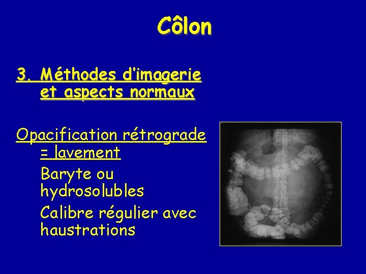 Imagerie du tube digestif Smiologie DCEM 1 Imagerie