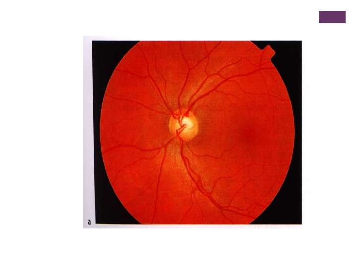 Structure and Function of the Eye SPE 516