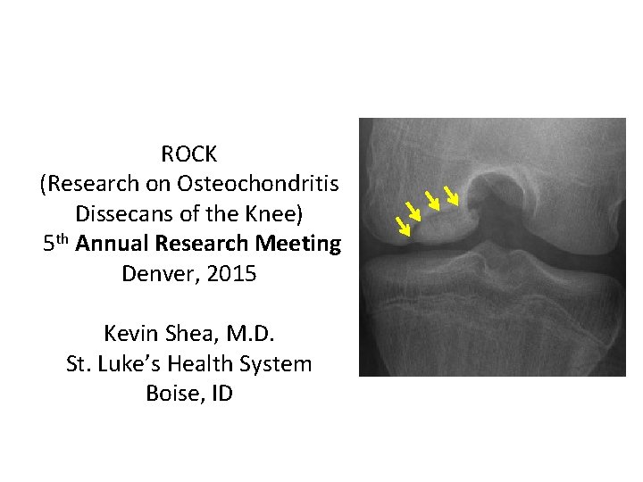 ROCK Research on Osteochondritis Dissecans of the Knee