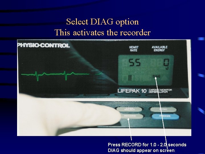Modified 9 lead Diagnostic ECG Using the PhysioControl