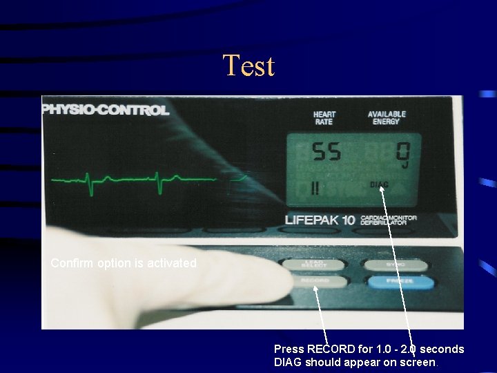 Modified 9 lead Diagnostic ECG Using the PhysioControl