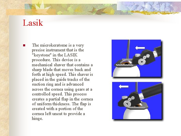 Lasers in Ophthalmology Anatomy of eye Anatomy of