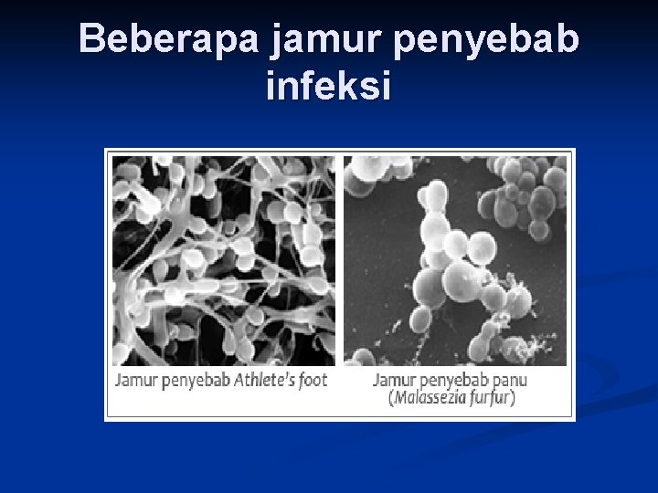 INFEKSI NOSOKOMIAL ANTI JAMUR ANTELMENTIK RAHMATINI Laboratorium ...