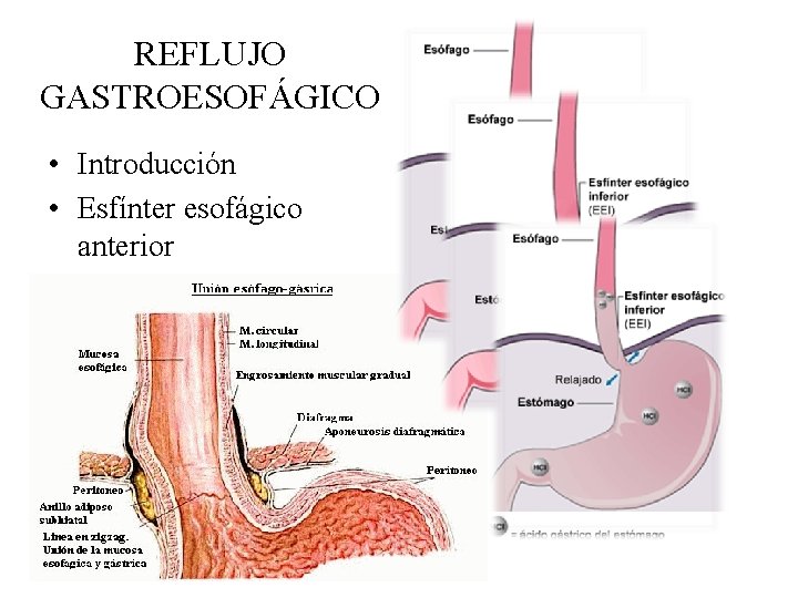 Aparato digestivo Introduccin ESFAGO ESTMAGO REFLUJO GASTROESOFGICO ...