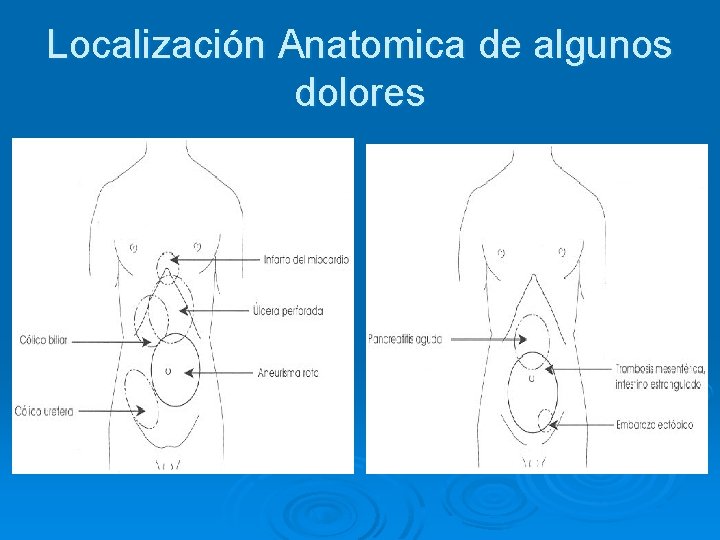 Abdomen Agudo Definicin El Abdomen Agudo es un