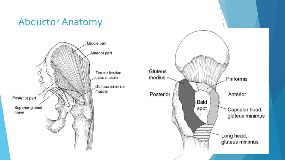 HIP INJURIES IN ATHLETES Focus on Femoroacetabular Impingement
