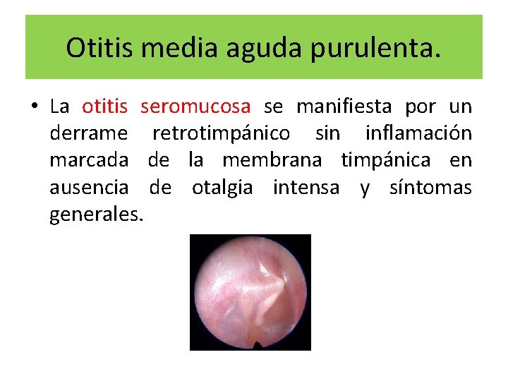 Infecciones Respiratorias Agudas Dr Jorge Barrientos Laucel Neumlogo