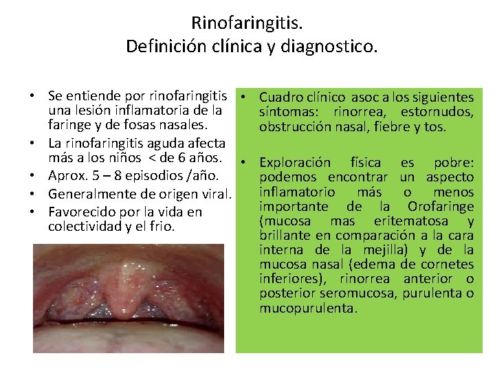Infecciones Respiratorias Agudas Dr Jorge Barrientos Laucel Neumlogo