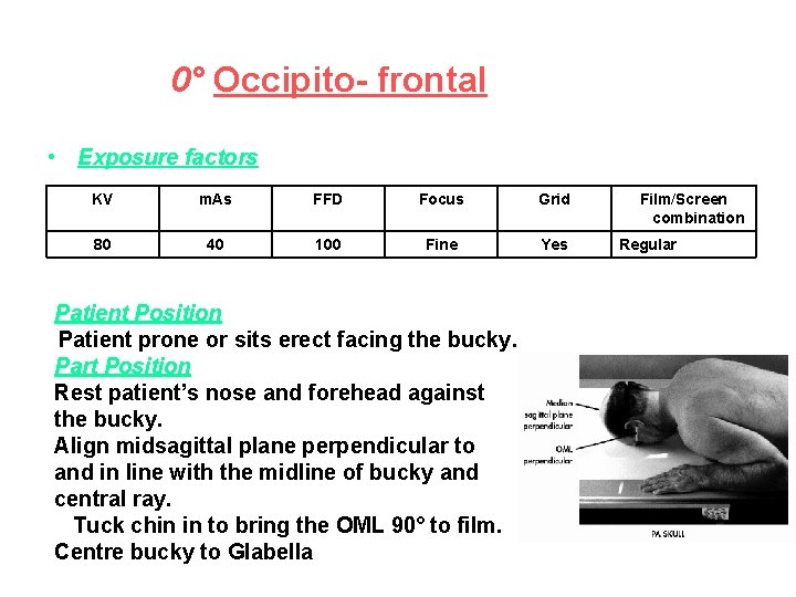 Lecture 27 Radiography of cranial Bones Basic 0Occipito