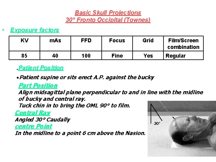 Lecture 27 Radiography of cranial Bones Basic 0Occipito