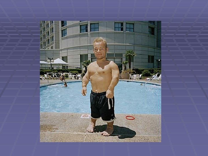 Achondroplastic Dwarfism By Keyon Harrison What is Achondroplastic