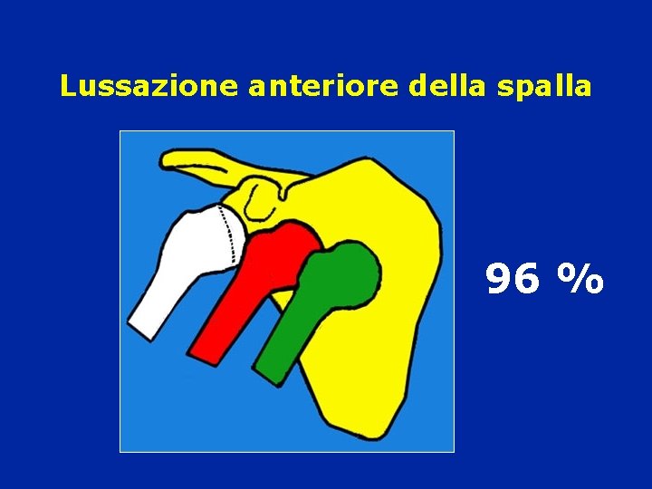 Lussazione della spalla anatomia anatomia La glena quasi