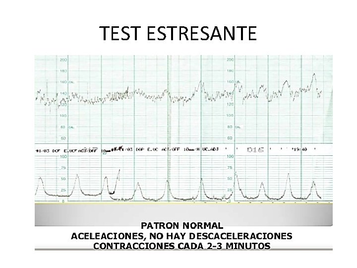 MONITOREO FETAL DRA DEBORAH GAIBOR OBJETIVO Identificacin oportuna
