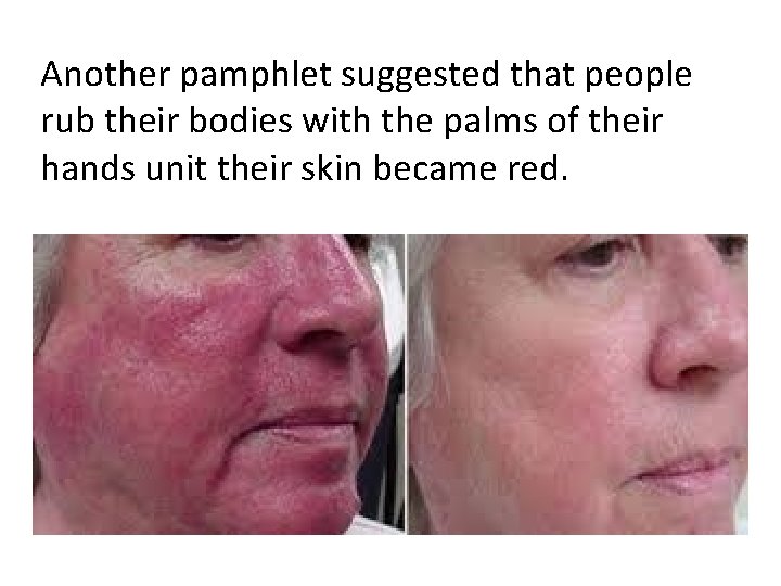 Hygiene in Elizabethan England Midsummer nights Dream was