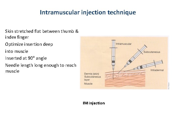 Injection Techniques Requirement needed to perform an injection