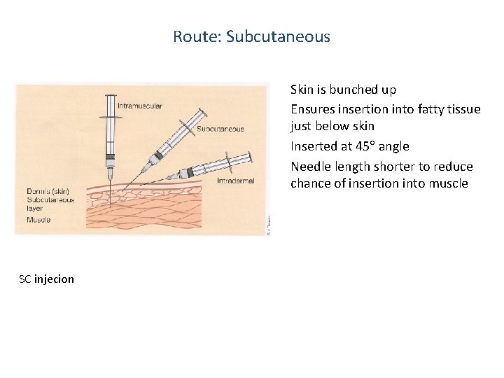 Injection Techniques Requirement needed to perform an injection