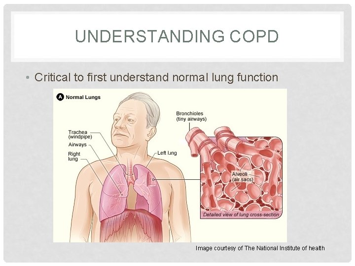 COPD CHRONIC OBSTRUCTIVE PULMONARY DISEASE Juliana Tambellini University