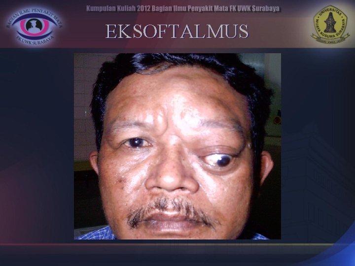ANATOMI FISIOLOGI MATA BAGIAN I P MATA FAKULTAS