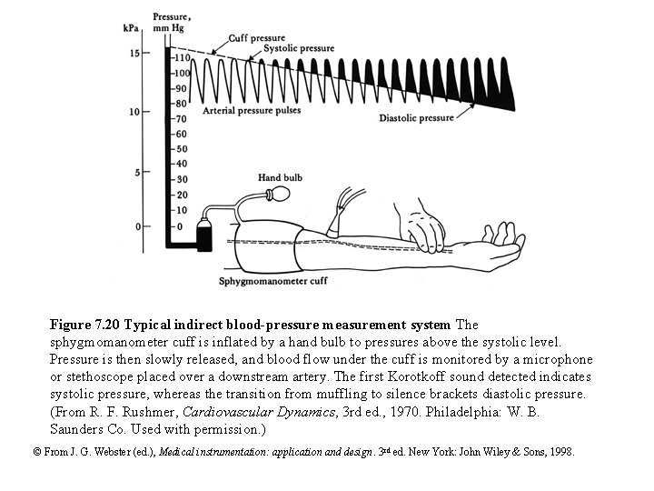 Figure 7 1 The left ventricle ejects blood