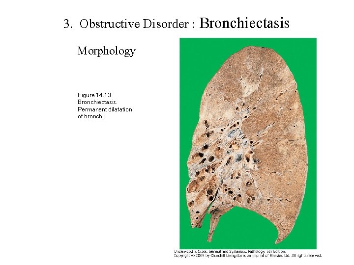 Course Outline 1 2 3 Obstructive and Restrictive