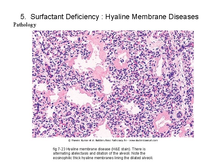 Course Outline 1 2 3 Obstructive and Restrictive