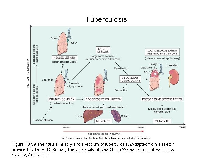 Course Outline 1 2 3 Obstructive and Restrictive