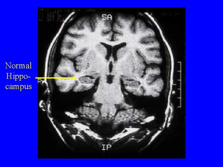 Clinical Brain Imaging Stephen Salloway M D M