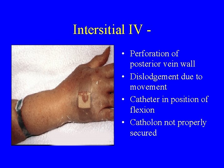 IV Therapy Advanced Paramedic Skills Intravenous Therapy Homeostasis