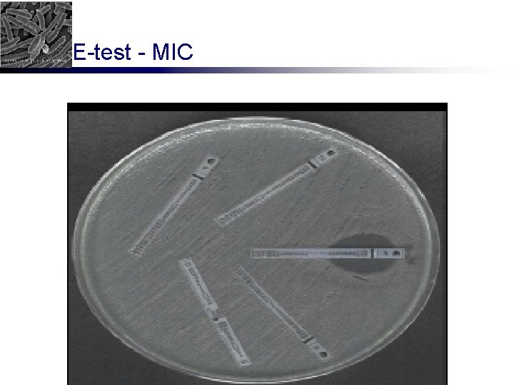 Testes de sensibilidade aos antimicrobianos Antibiticos Mecanismos de