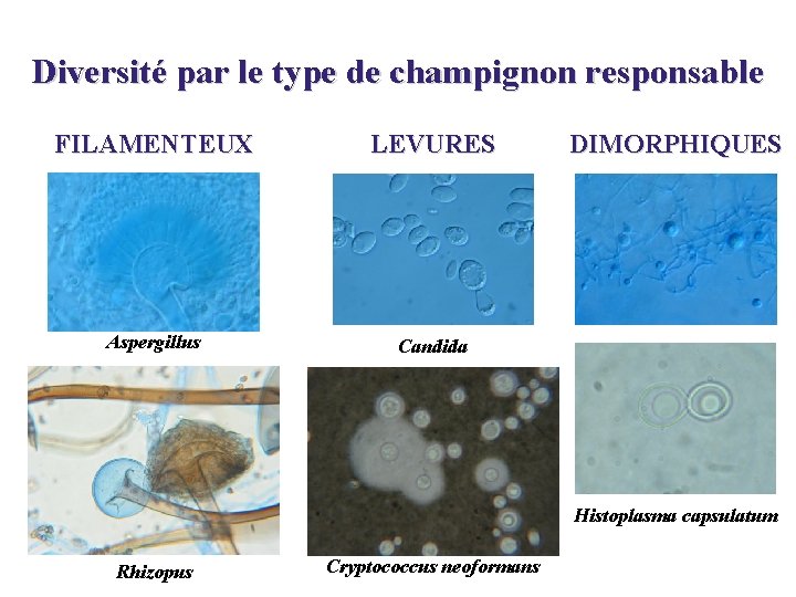 Les champignons microscopiques et les infections quils provoquent