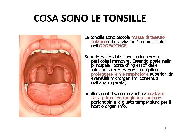 TONSILLECTOMIA ASSISTENZA PRE E POST OPERATORIA AL PAZIENTE