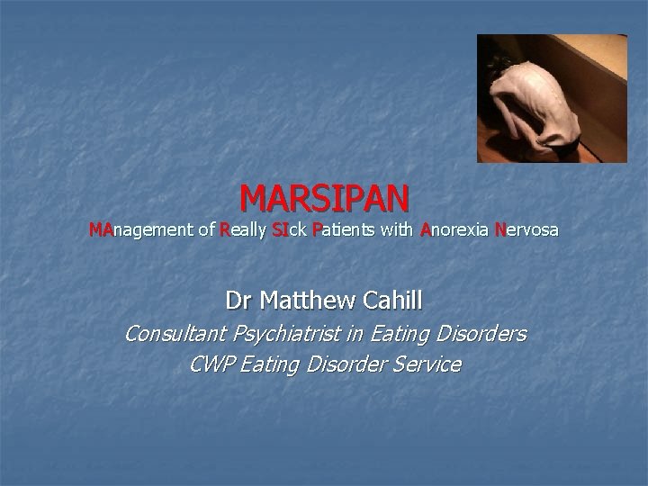 MARSIPAN MAnagement of Really SIck Patients with Anorexia