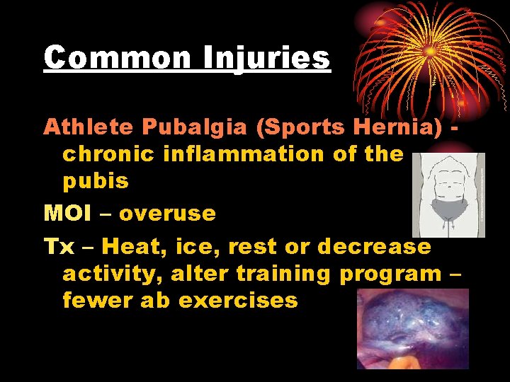 Athletic Training Ch 8 Hip and Pelvis Objectives