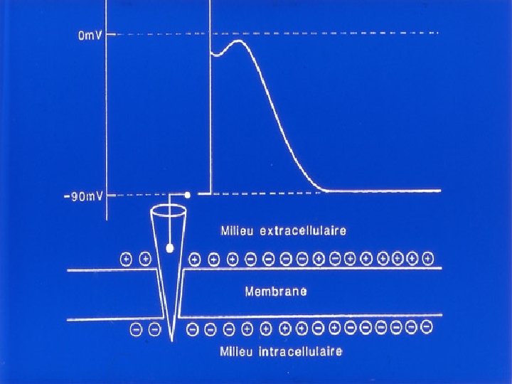 TROUBLES DU RYTHME ET DE LA CONDUCTION ECG