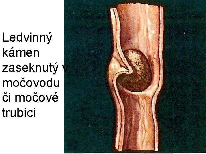 Anatomick stavba ledvin C Mgr Martin md Uloen