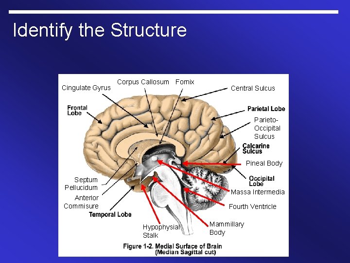 Gross Anatomy Skull and brain 12110 Identify the