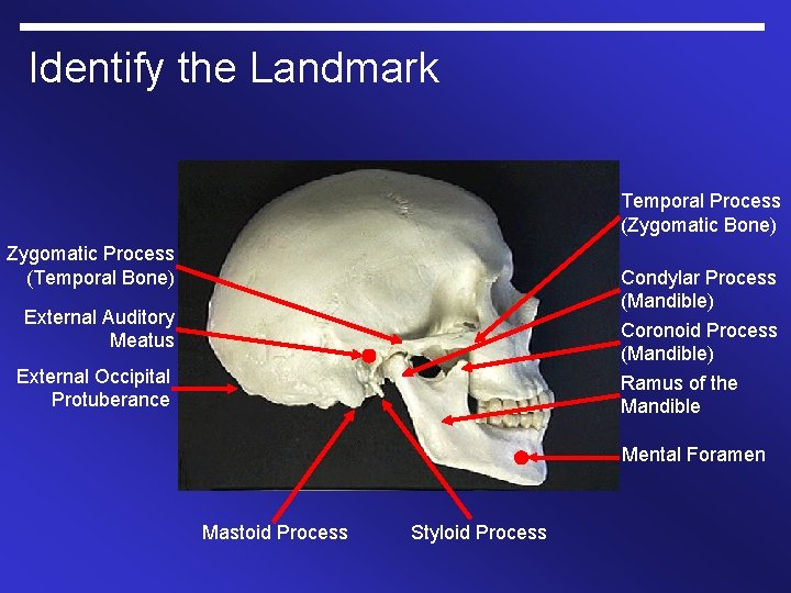 Gross Anatomy Skull and brain 12110 Identify the