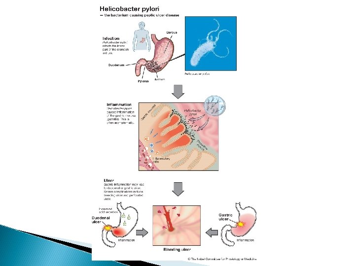 Campylobacter spp Helicobacter pylori Microbiologa I2011 M Paz