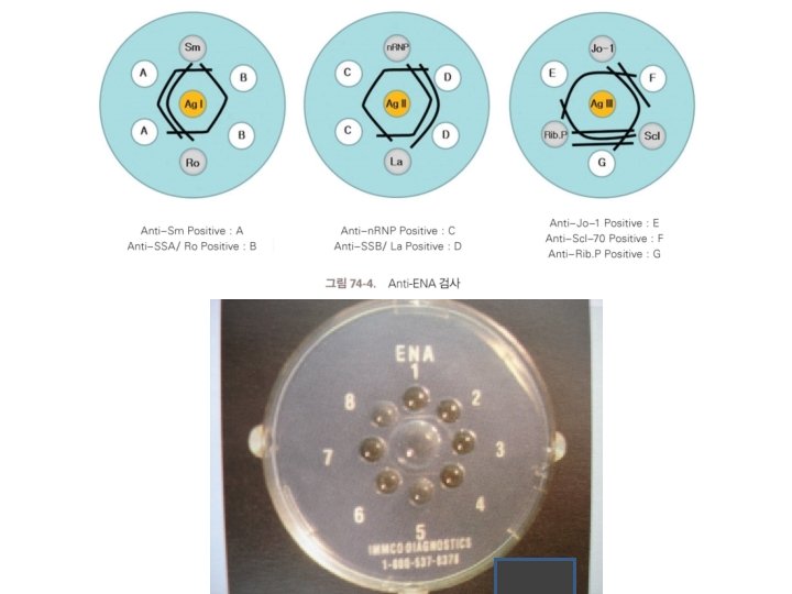 Immunoassay Precipitation Manual Double immunodiffusion Automation ...