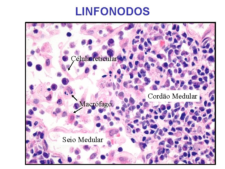 SISTEMA LINFTICO constituise em vasos linfticos tecidos e