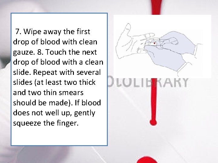 Preparation of thick thin blood film for detection
