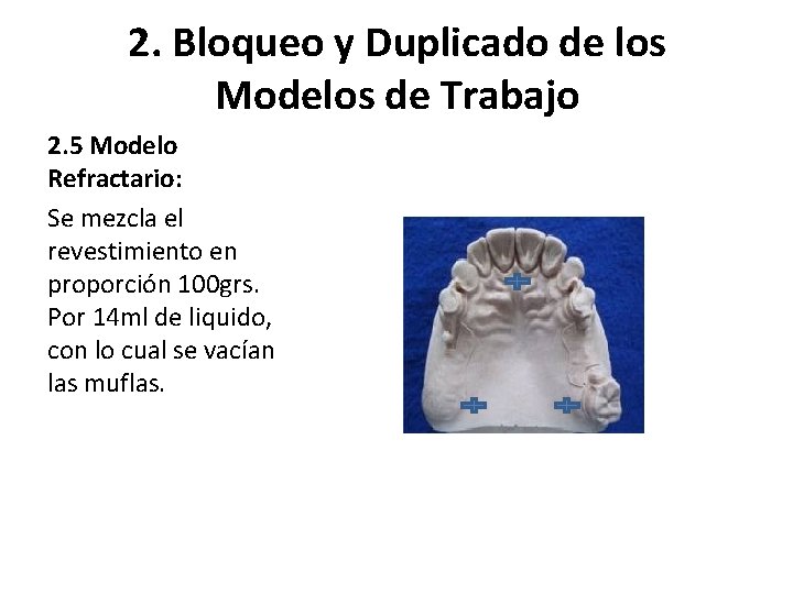 Proceso de Laboratorio para Prtesis Parcial Removible de