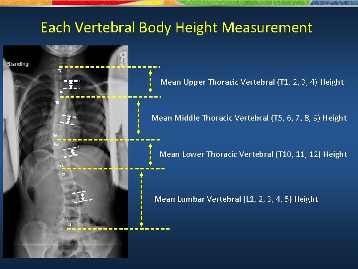 Growth of the Spine in Early Onset Idiopathic