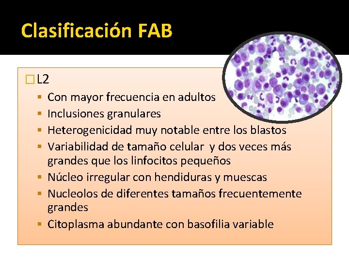Leucemia Linfoblstica Aguda LLA Dulce Mara Luna Cano