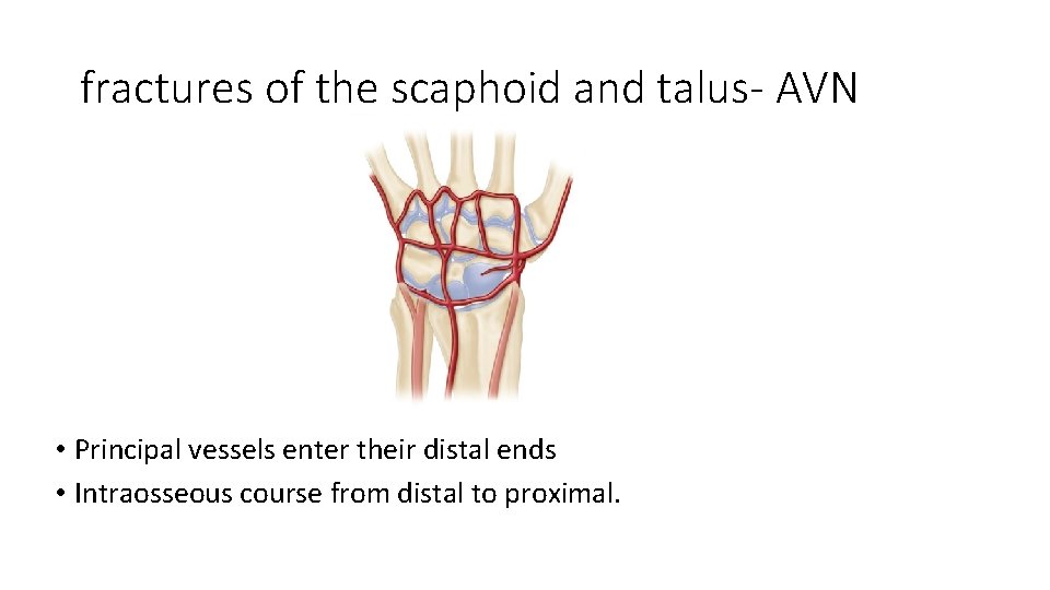 Avascular Necrosis Dr R B Kalia Additional Professor