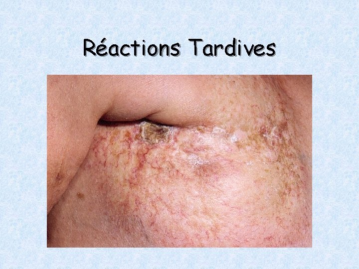 Effets Biologiques des Radiations Ionisantes Pr Bernard DUBRAY