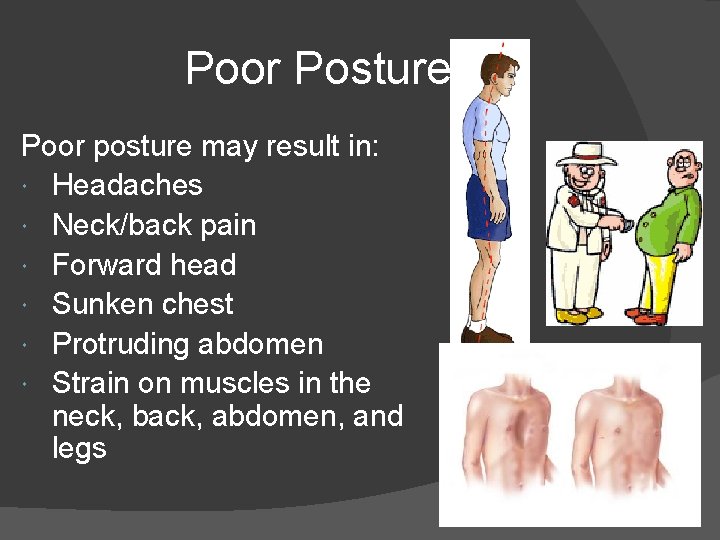Module 4 Importance of Correct Posture Common Postural