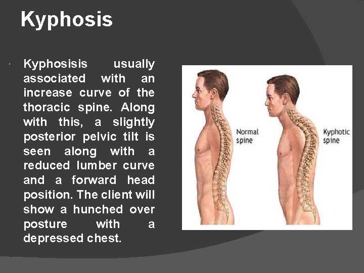 Module 4 Importance of Correct Posture Common Postural